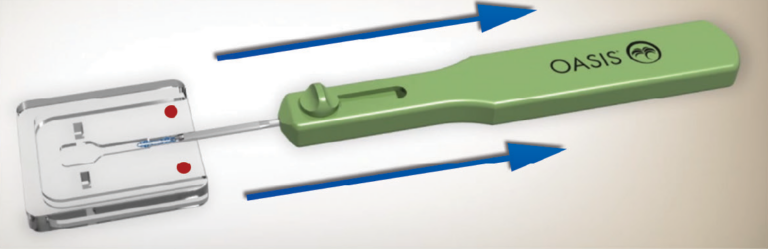 OASIS Iris Expansion Resource Page – OASIS® Medical
